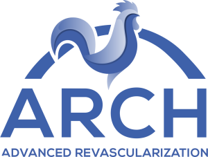 Arch - ARCH